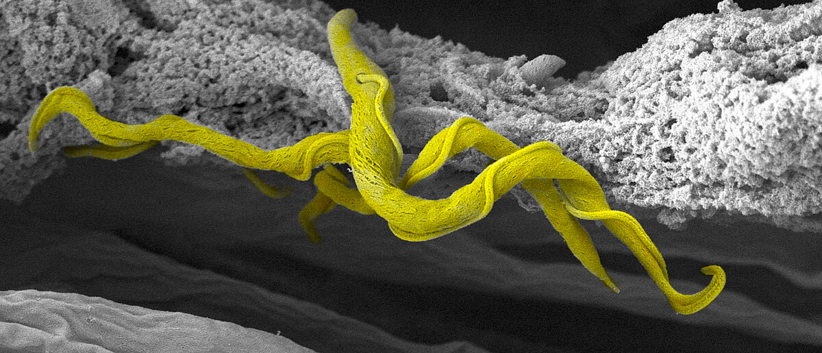 The Physics of Parasites