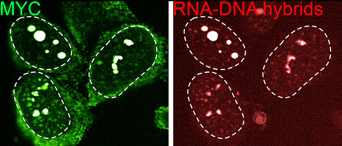 Decoded: How cancer cells protect themselves from the immune system